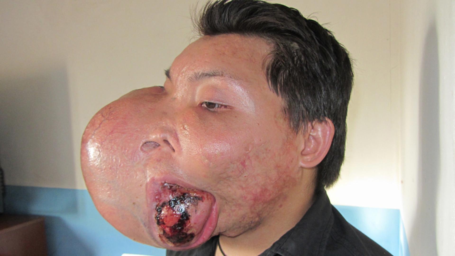 Watch Body Bizarre: S2E11 - My New Face on Philo (Free Trial)