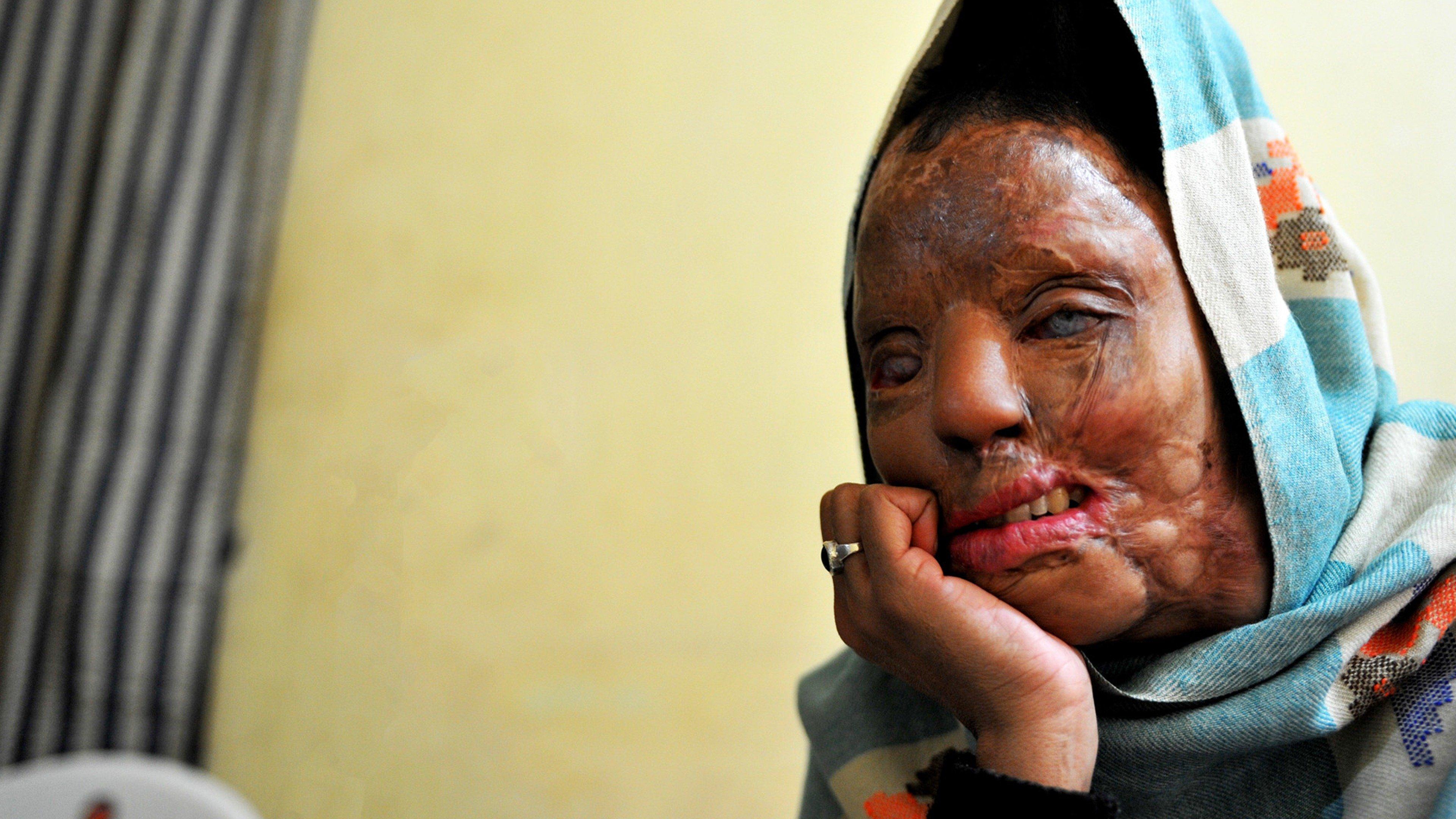 Body Bizarre: My Body Is Turning to Stone