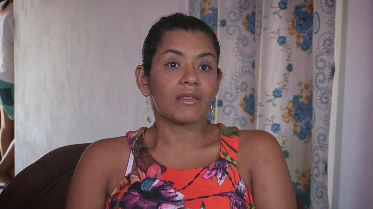 Body Bizarre: My Extra Large Head