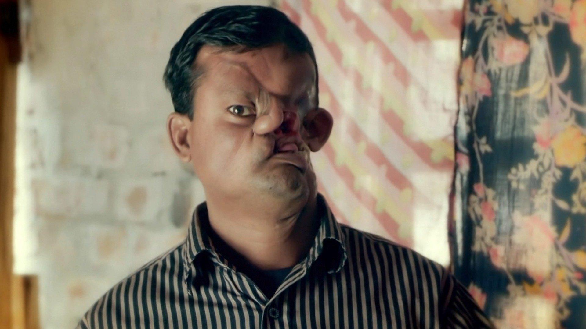 Body Bizarre: My Skin is Falling Off