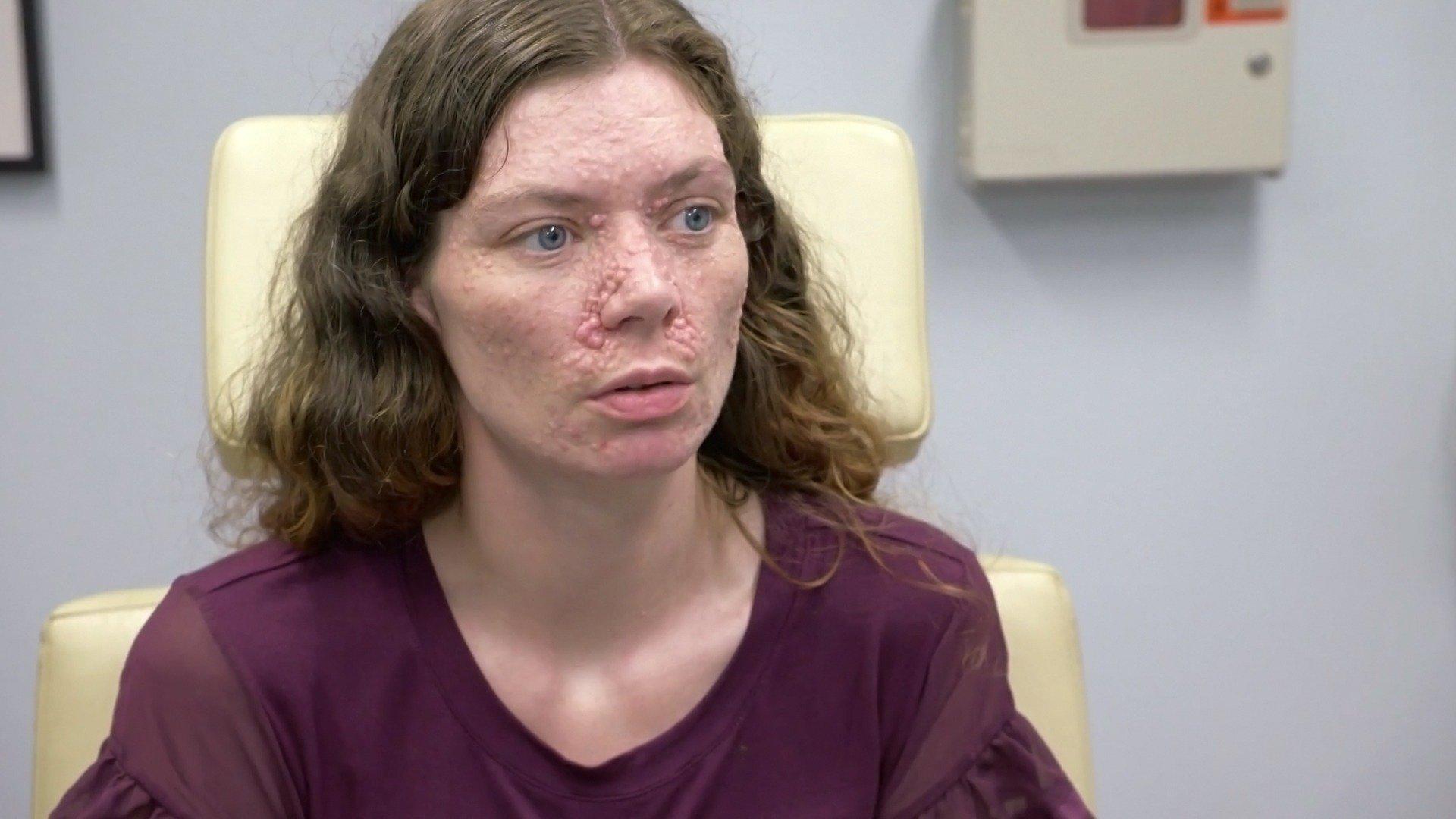 Dr. Pimple Popper: Sisters Lumpity Lump Lump