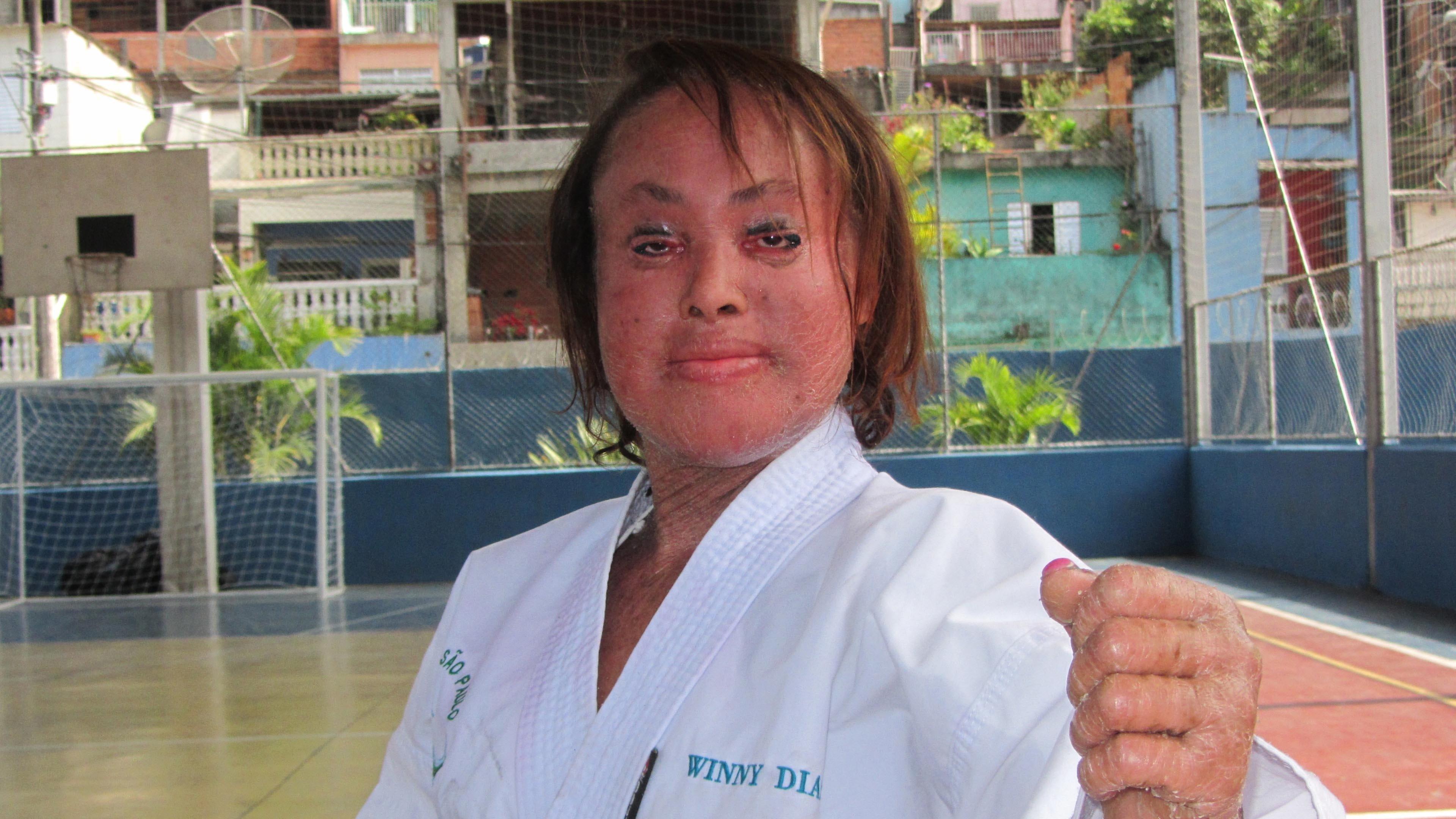 Body Bizarre: My Heart Lives on the Outside