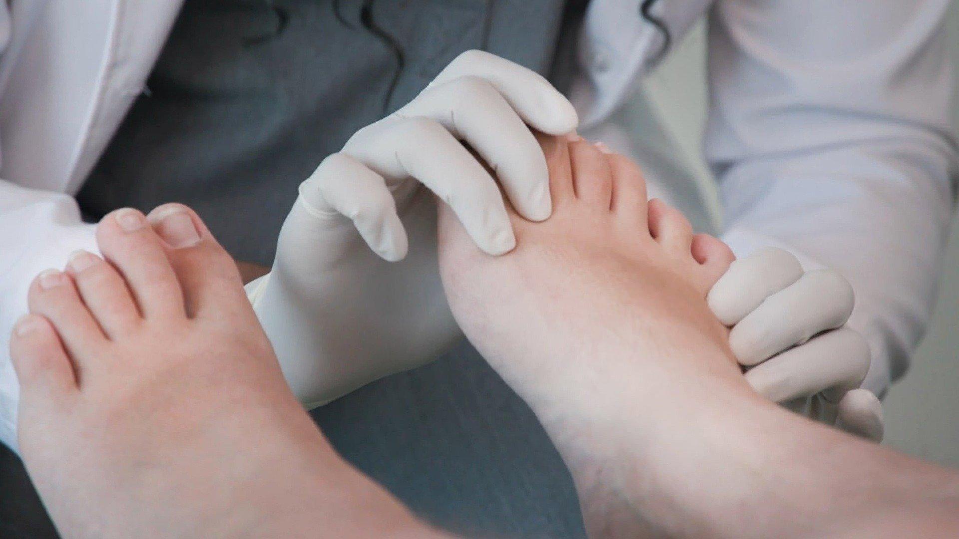 My Feet Are Killing Me: Sixth Toe Surprise