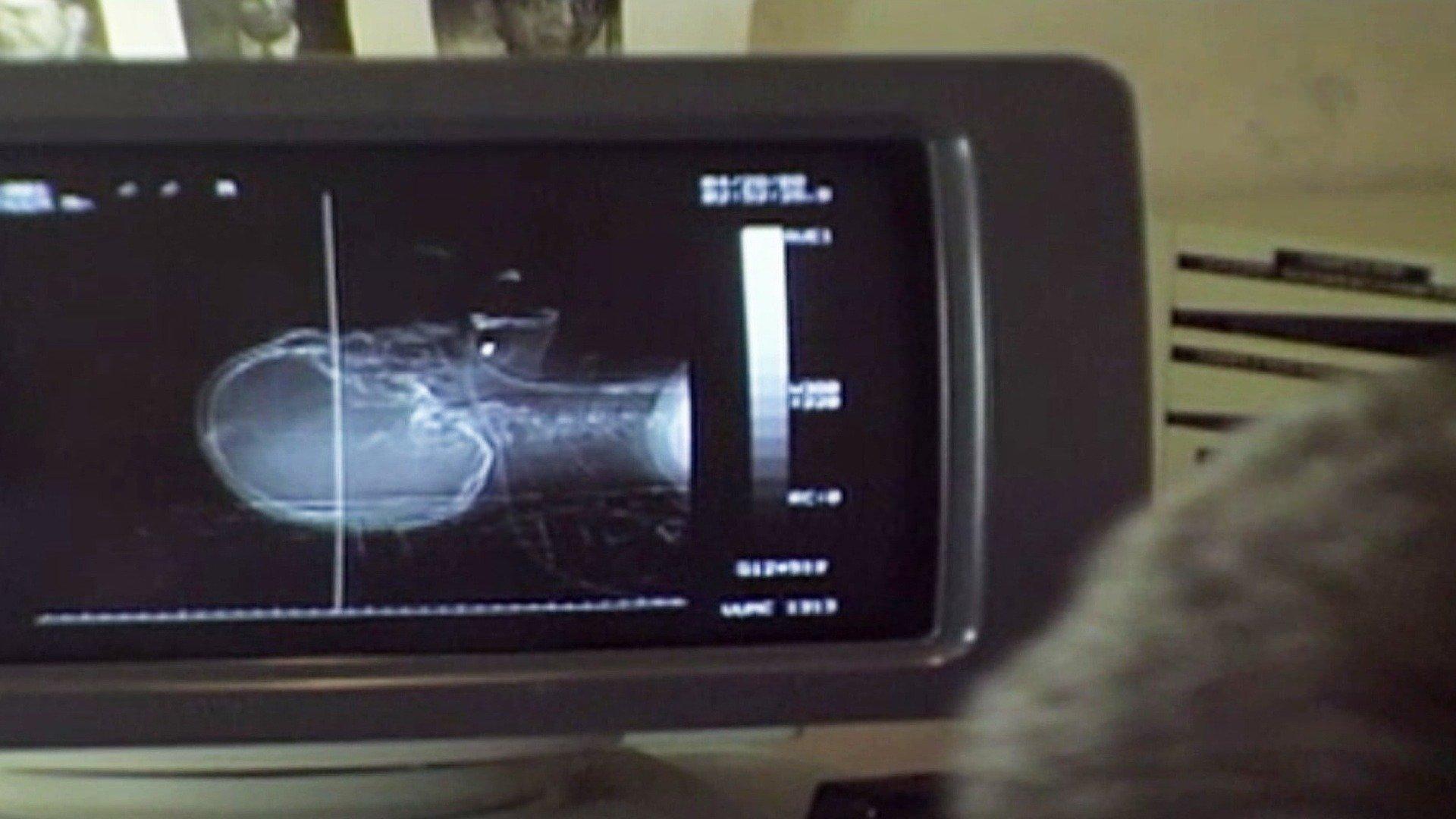 Trauma: Life in the ER: Playing With Fire