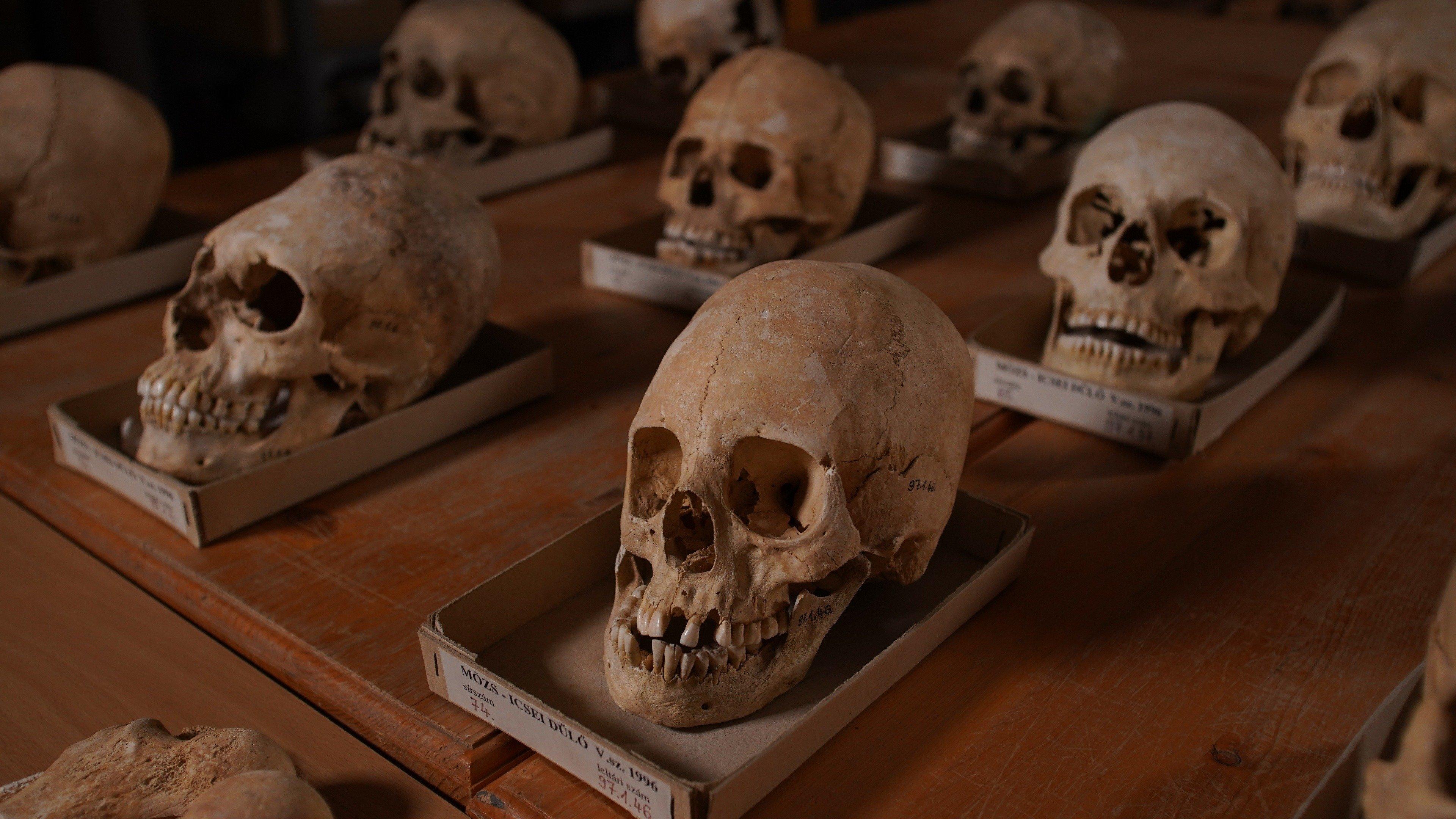 Watch Secrets: S7E5 - Riddle of the Roman Skulls on Philo (Free Trial)
